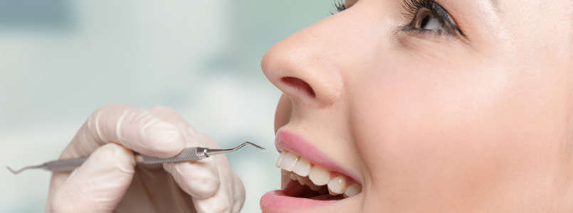 Prophylaxe: Die professionelle Zahnreinigung beim Zahnarzt | dentolo